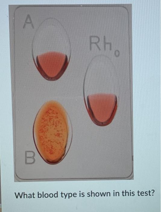 Solved A Rho B. What blood type is shown in this test? | Chegg.com