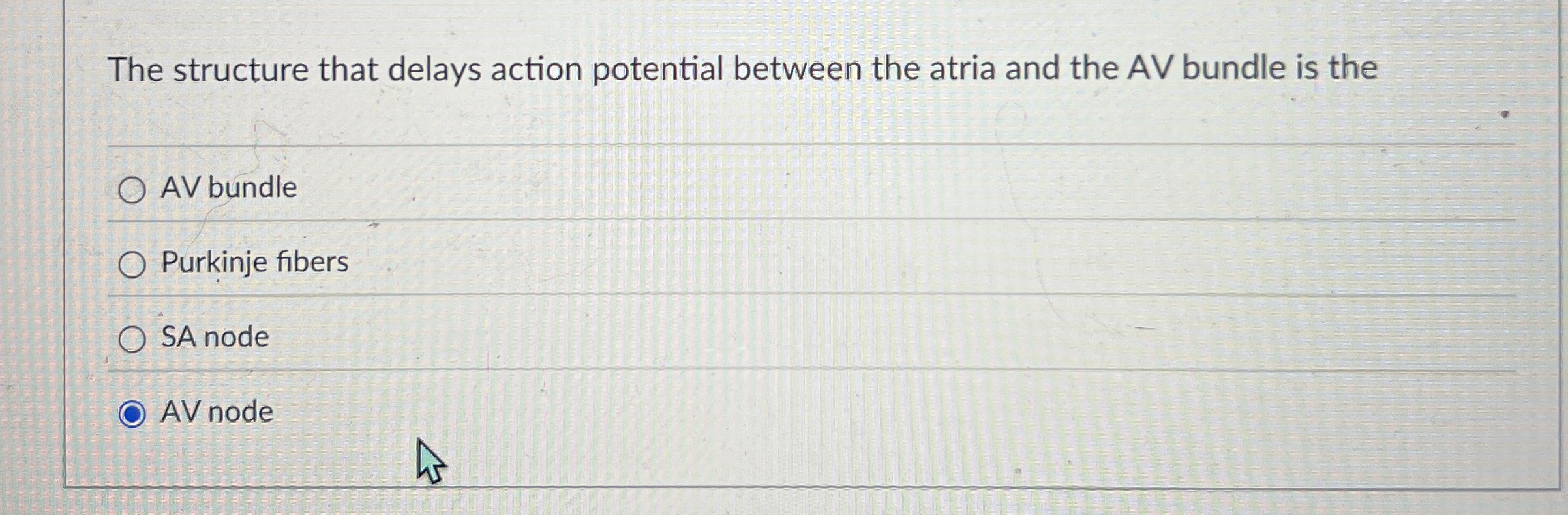 Solved The structure that delays action potential between | Chegg.com