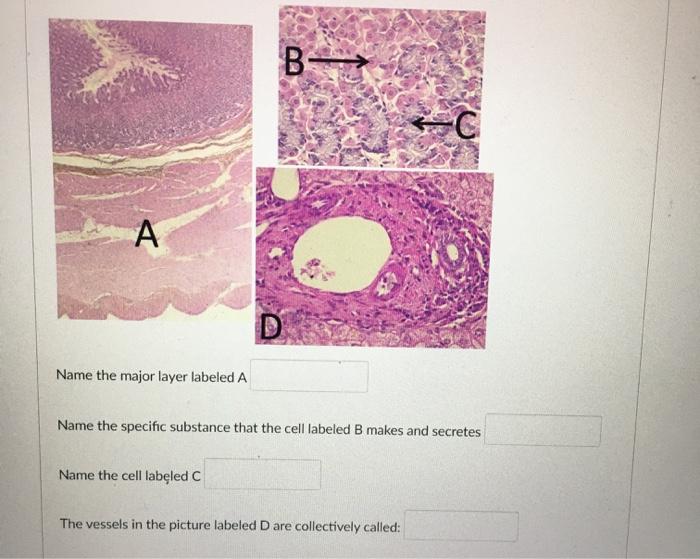 Solved С 3L B A. D Name the pouch-like structure labeled A | Chegg.com