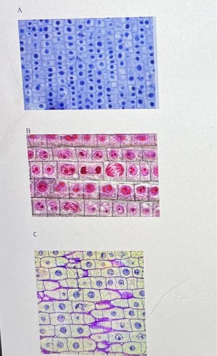 Solved 7) Count the number of cells in Interphase, prophase, | Chegg.com