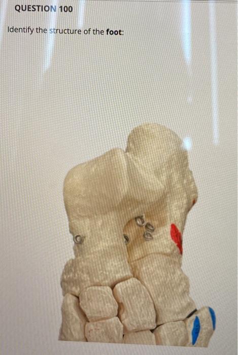 Solved Cuboid Lateral cuneiform Navicular Intermediate | Chegg.com