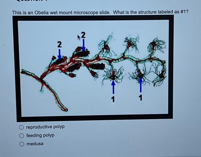 This is an Obelia wet mount microscope slide. What is | Chegg.com