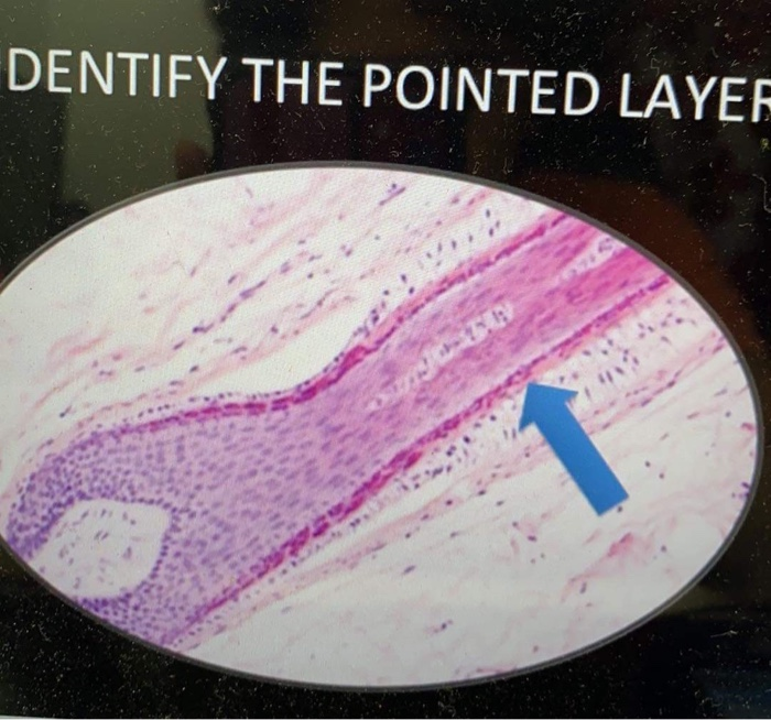 Solved DENTIFY THE POINTED LAYER 1 | Chegg.com