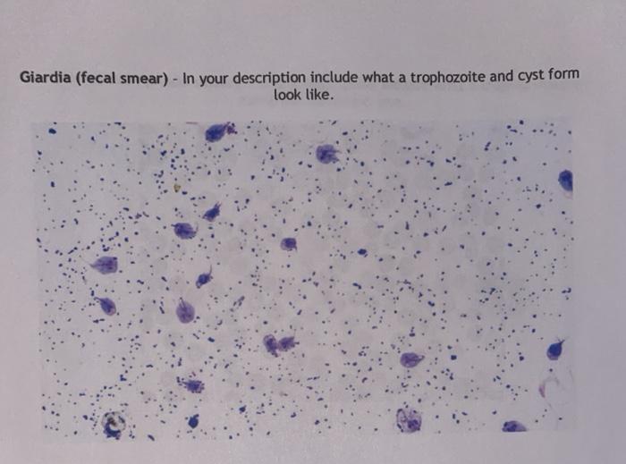 Solved Giardia (fecal smear) - In your description include | Chegg.com
