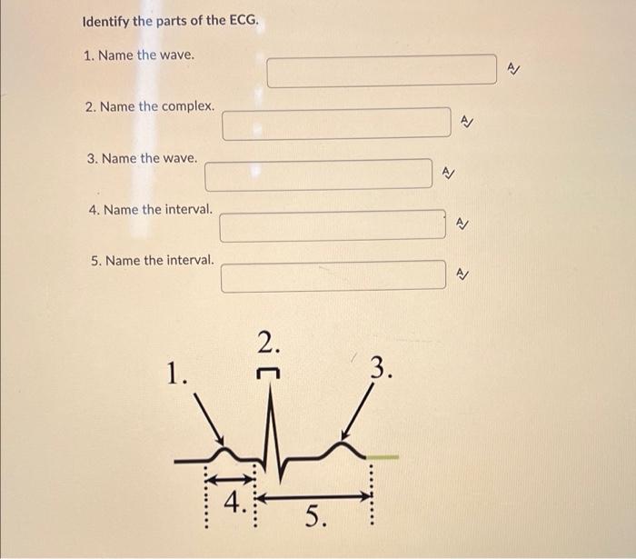 Solved Identify the parts of the ECG. 1. Name the wave. ^/ | Chegg.com