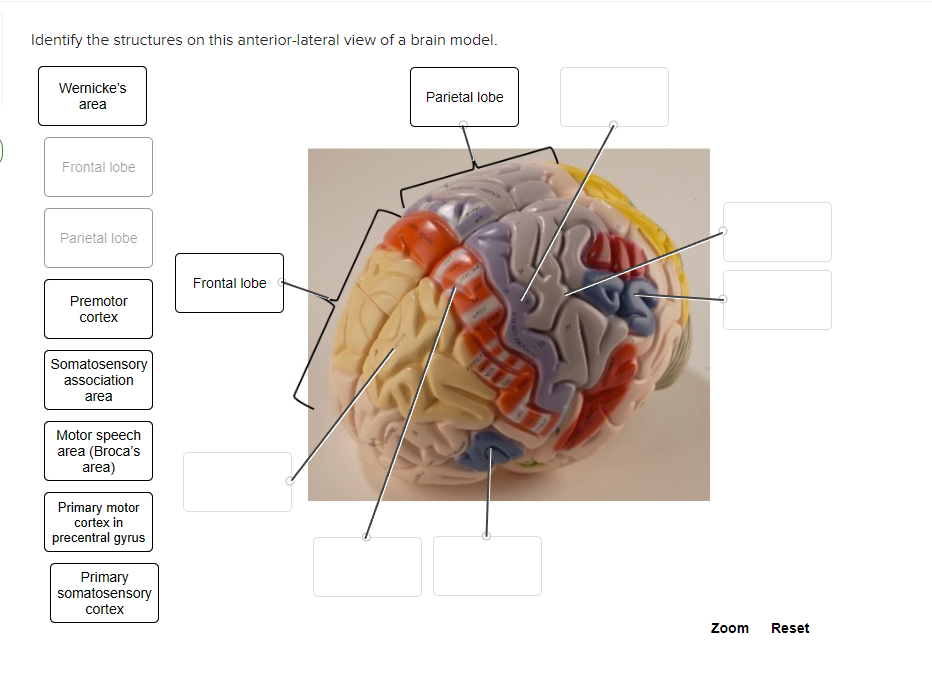 Solved Identify the structures on this anterior-lateral view | Chegg.com