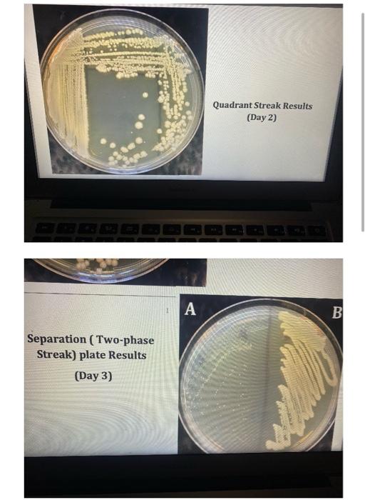 Solved EXERCISE 18 Identification of Unknown Microbial | Chegg.com
