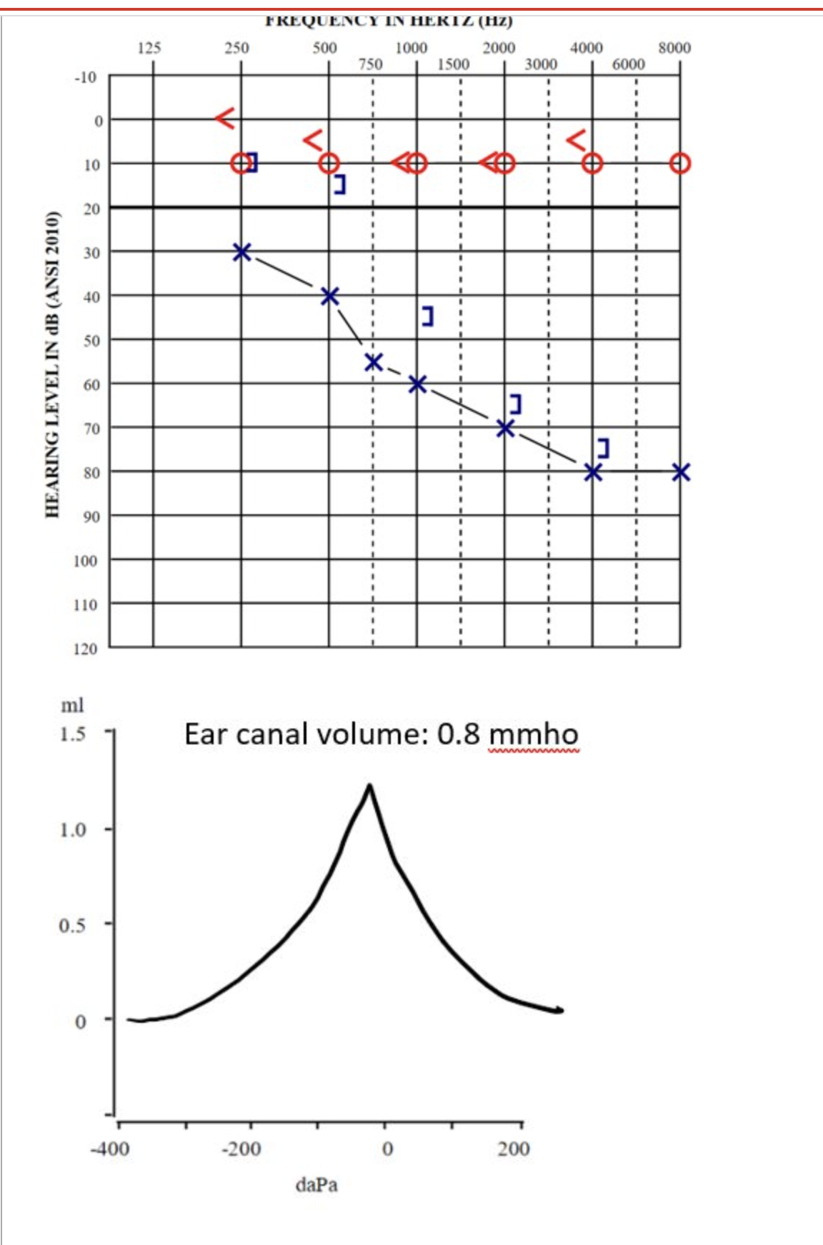 Solved Was the above audiogram masked at all required | Chegg.com