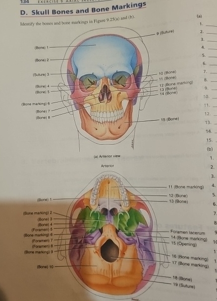 Solved D. ﻿Skull Bones and Bone MarkingsIdentify the bones | Chegg.com