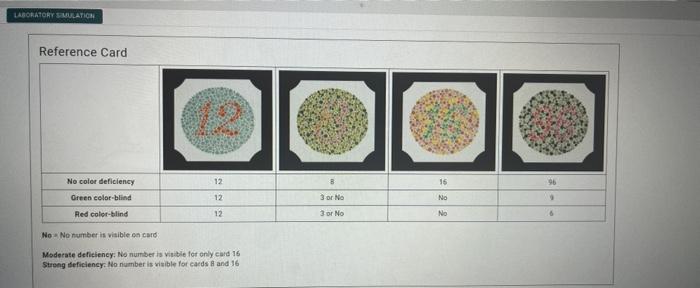 Solved please write a laboratory report on Eye and vision- | Chegg.com
