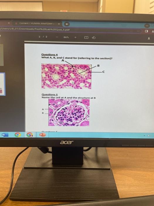 Solved Questions 4 What A,B, and C stand for (relerring to | Chegg.com