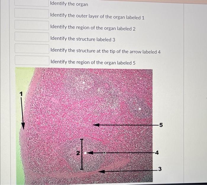 Solved Identify the organ Identify the outer layer of the | Chegg.com