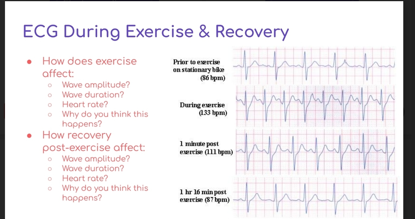 Solved ECG During Exercise & RecoveryHow does exercise | Chegg.com