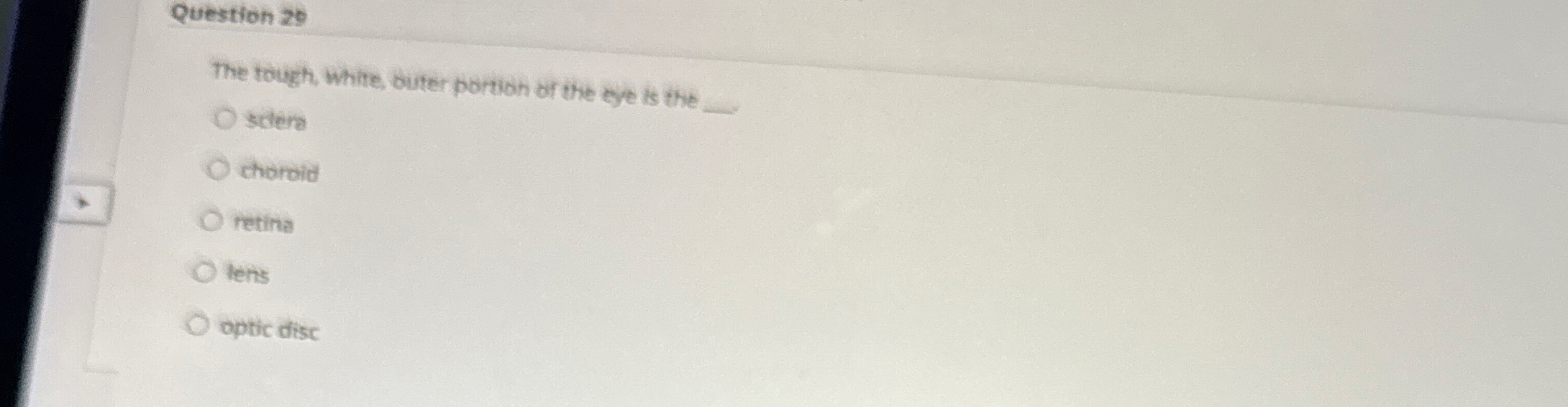 Solved Question 20The tough, white, outer portion of the eye | Chegg.com