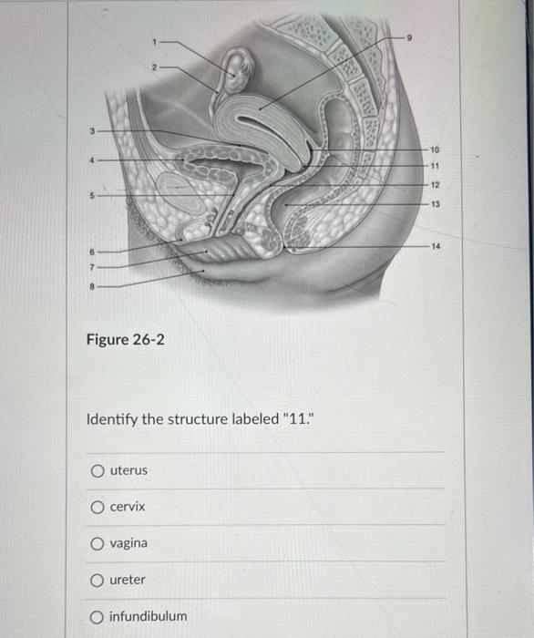 Solved Figure 26-2 Identify the structure labeled "11." | Chegg.com