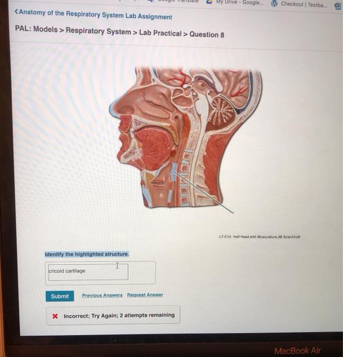 Solved My Drive - Google W Checkout Testbane Respiratory | Chegg.com