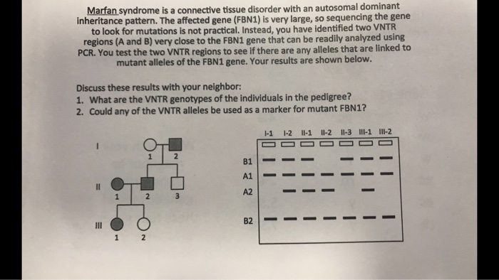 Solved Marfan syndrome is a connective tissue disorder with | Chegg.com