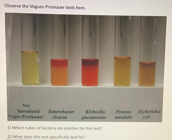 Solved Interpret the following nitrate reduction test | Chegg.com