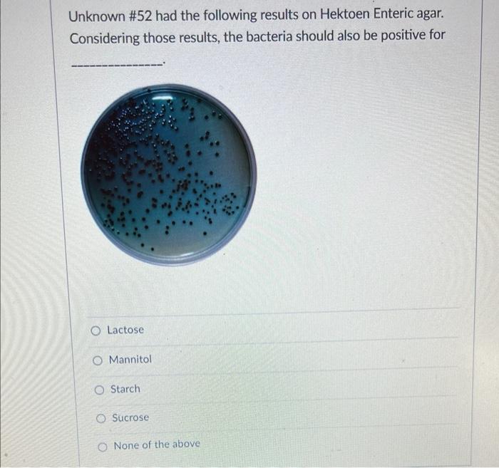 Hektoen Enteric Agar Positive Result