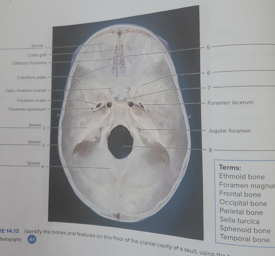 Solved (bone)Crista galliOlfactory foraminaCribriform | Chegg.com