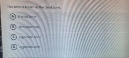 Solved This bone is known as the cheekbone. ﻿Frontal | Chegg.com