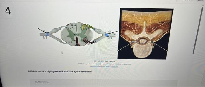Solved Which structure is highlighted and indicated by the | Chegg.com
