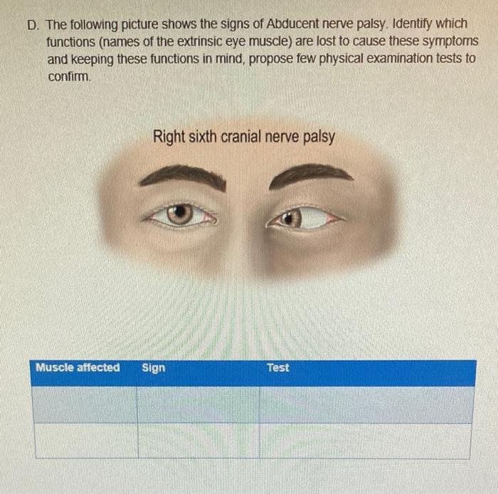 Solved D. The following picture shows the signs of Abducent | Chegg.com