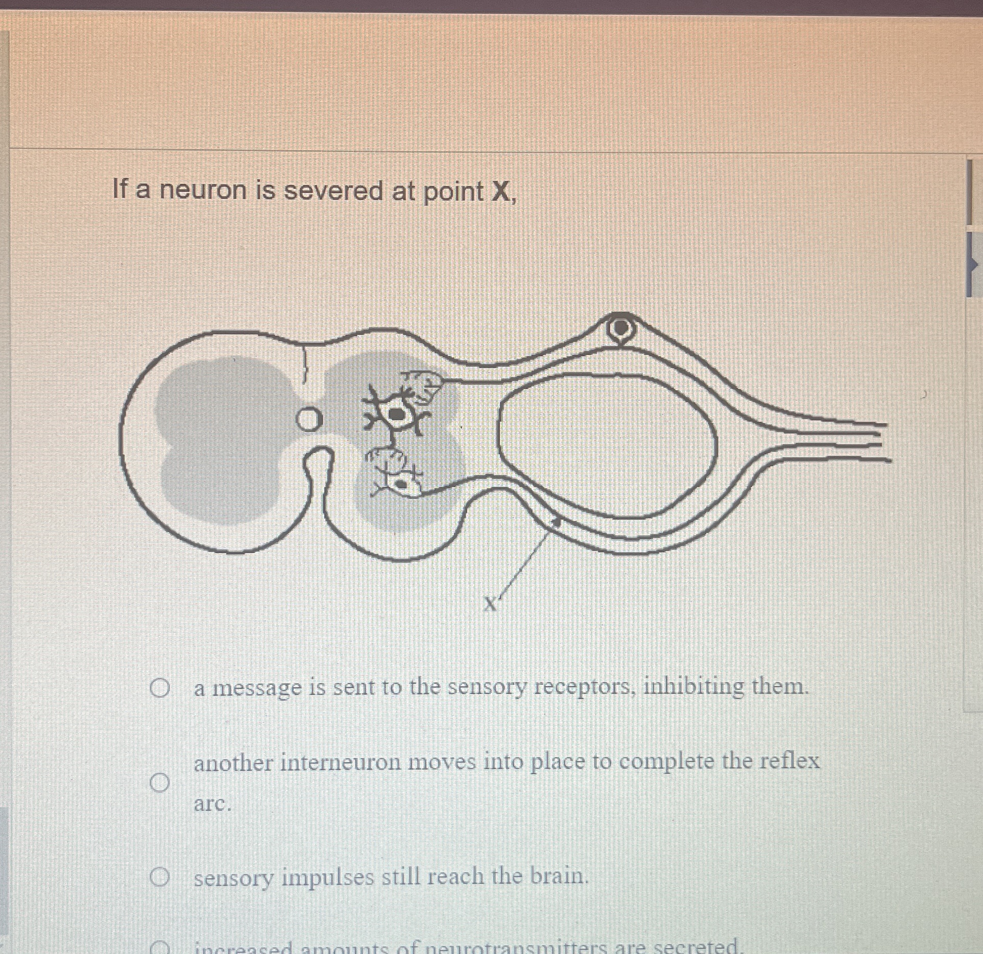 Solved If a neuron is severed at point x,a message is sent | Chegg.com