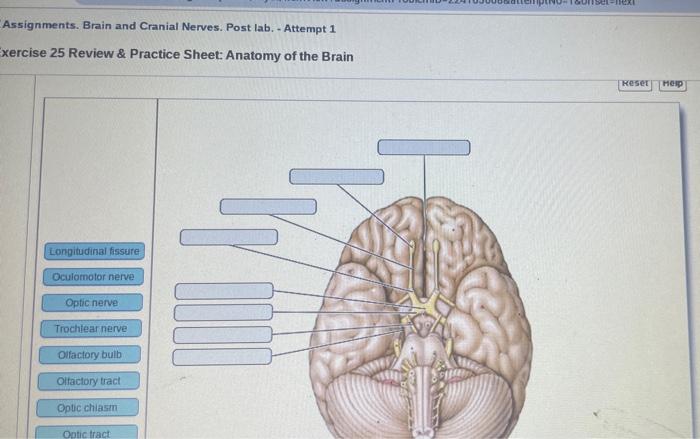 Solved Assignments. Brain and Cranial Nerves. Post lab. - | Chegg.com