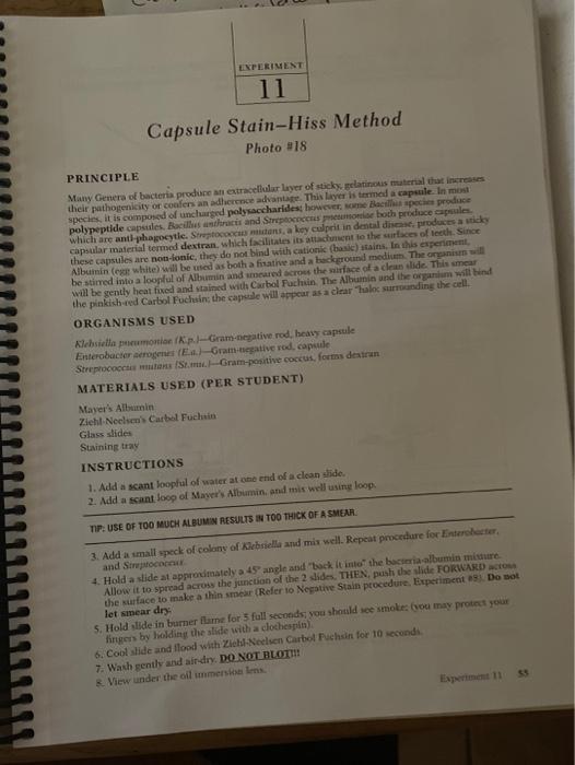 Solved EXPERIMENT 11 Capsule Stain-Hiss Method Photo 918 | Chegg.com