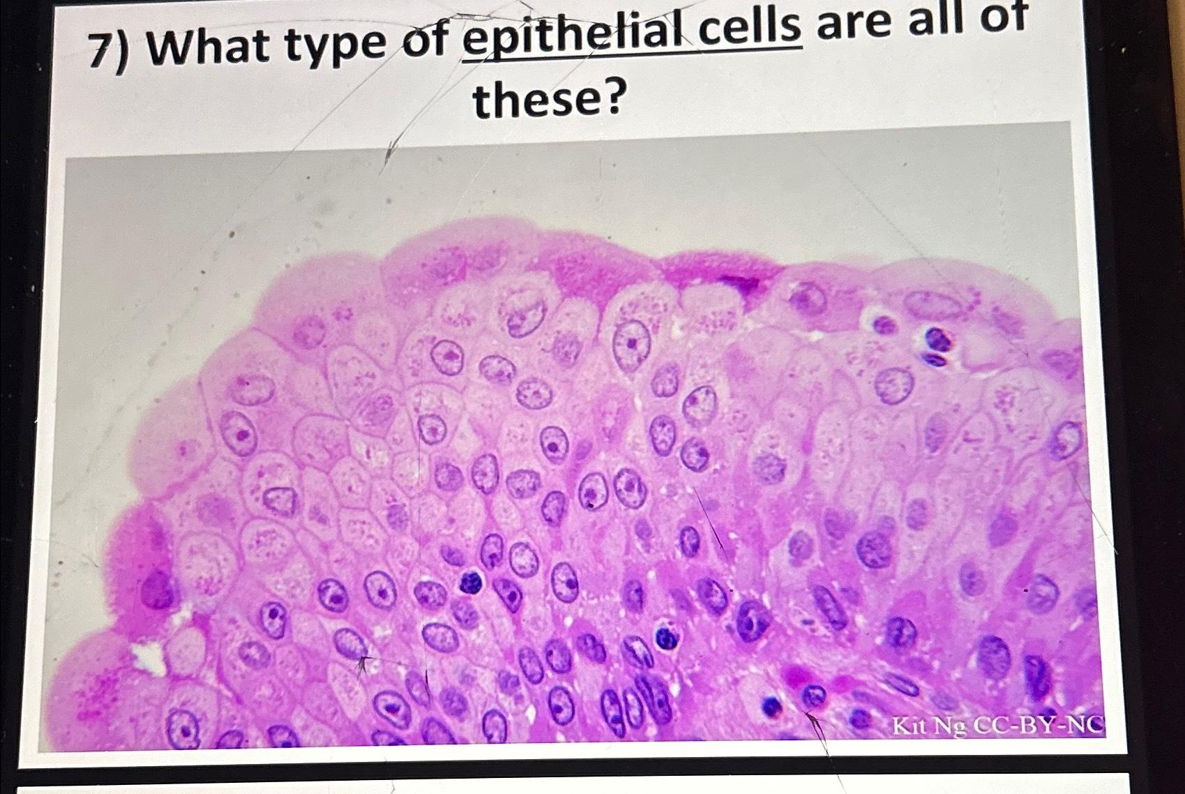 Solved What type of epithelial cells are all of these? | Chegg.com