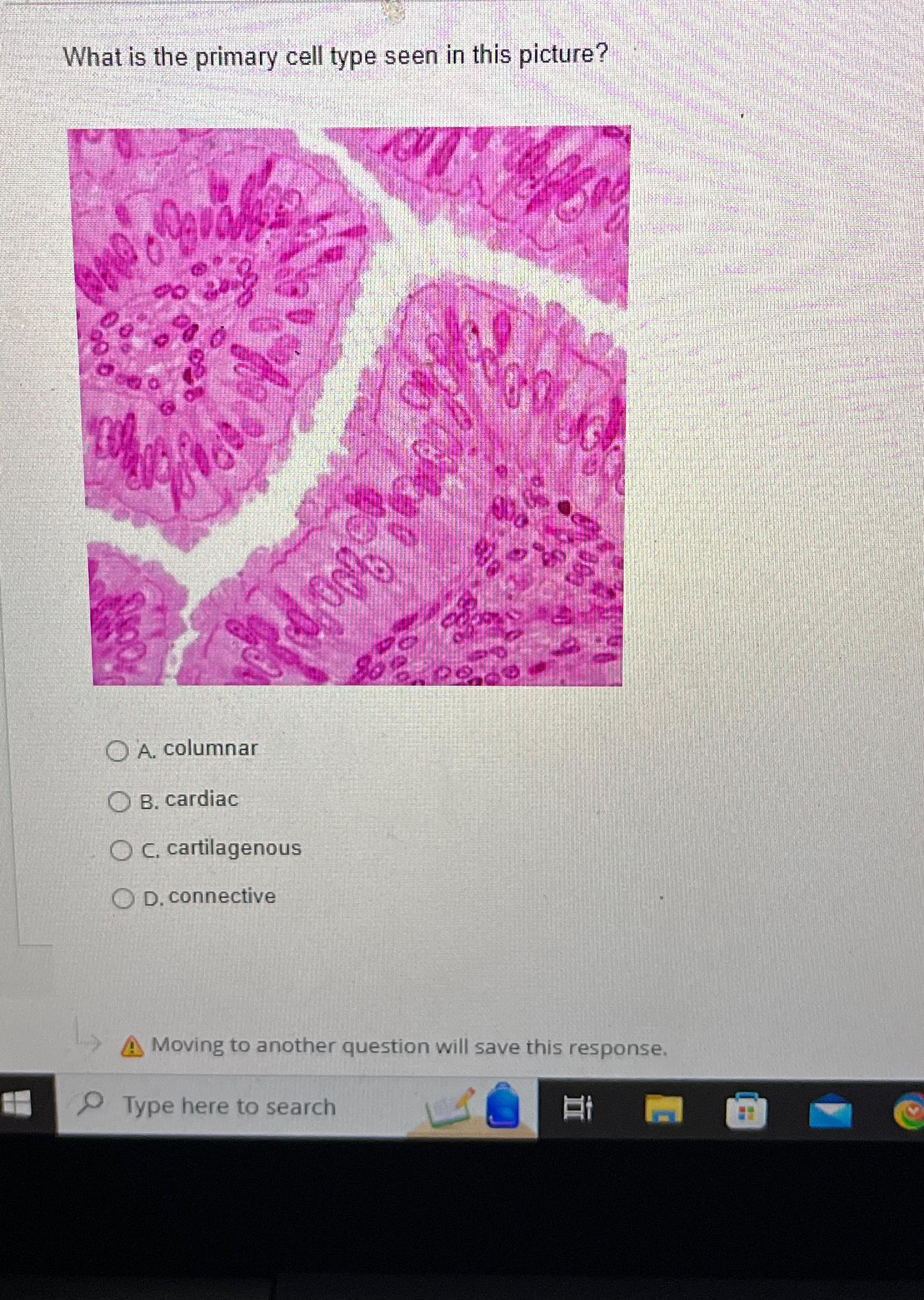 Solved What is the primary cell type seen in this picture?A. | Chegg.com