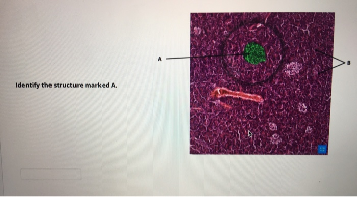 Solved Identify the structure marked A. | Chegg.com