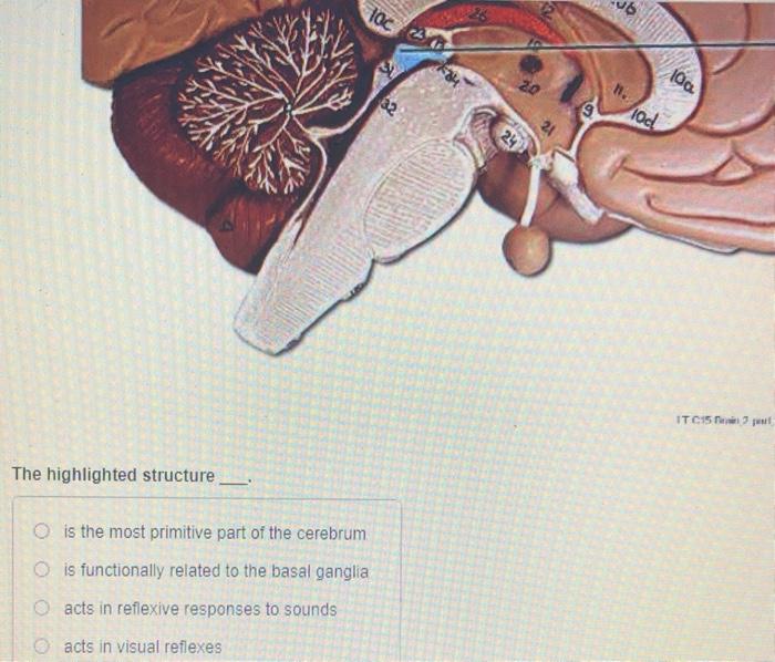 Solved 10C 46 100 11 iod IT C15 The highlighted structure O | Chegg.com