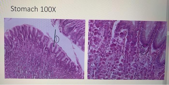 Solved Tonsil 40X Esophagus 40x D3 Tongue 100% DOX Liver | Chegg.com