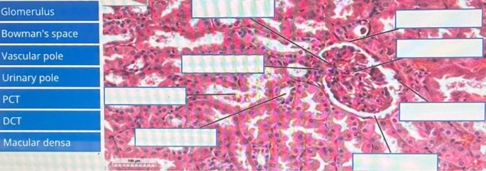 Solved Glomerulus Bowman's space Vascular pole Urinary pole | Chegg.com
