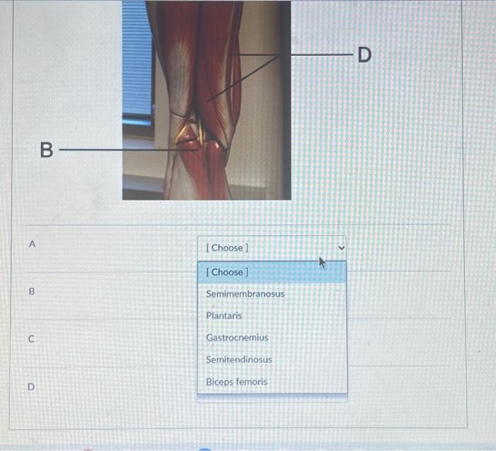 Solved Match the labeled muscles with their correct name. | Chegg.com