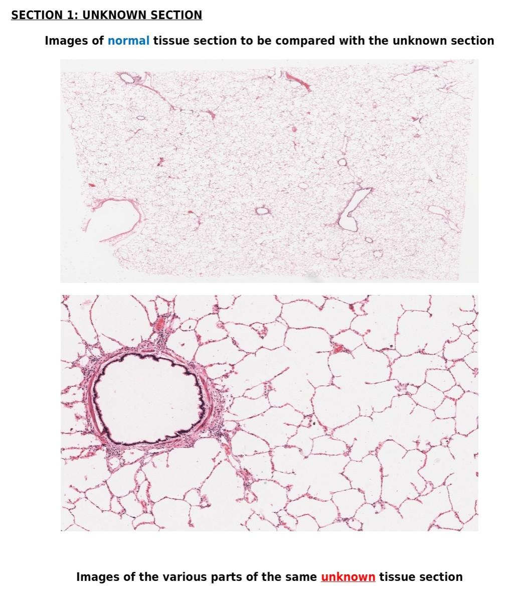 SECTION 1: UNKNOWN SECTION Images of normal tissue | Chegg.com