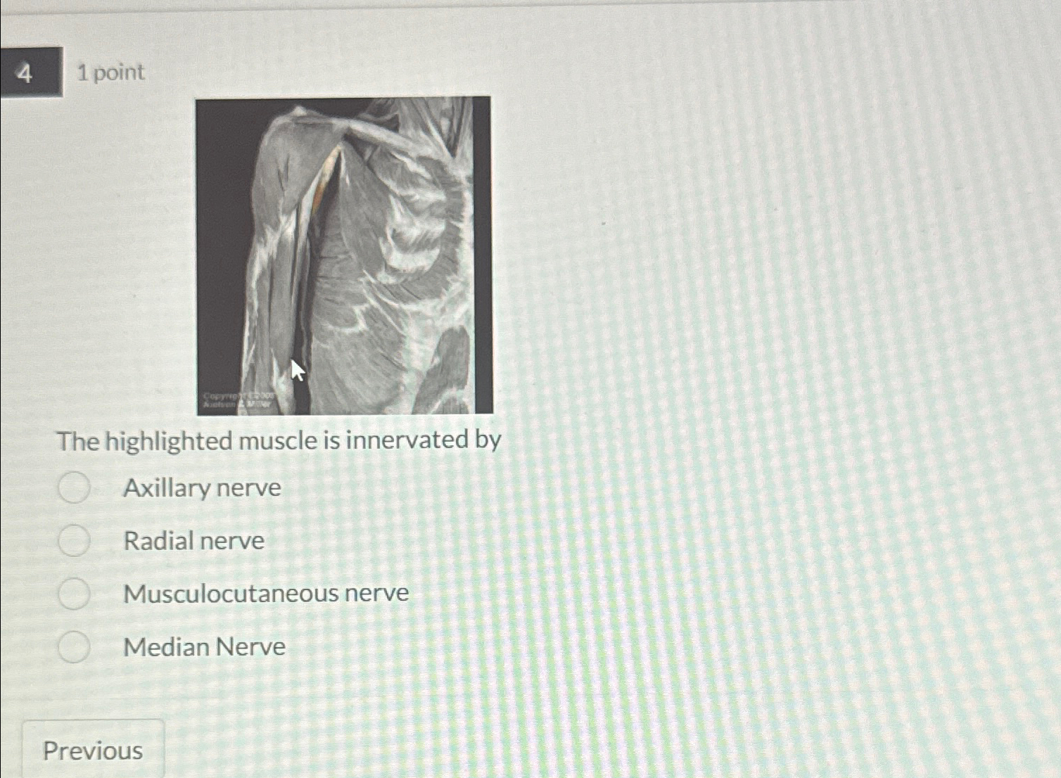 Solved 41 ﻿pointThe highlighted muscle is innervated | Chegg.com