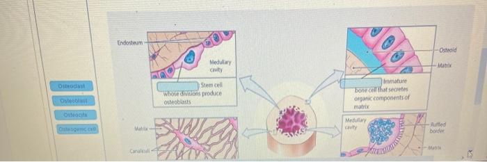 Solved Olul Endostem Ostrold Medullary аму Mb ON Stemcell | Chegg.com