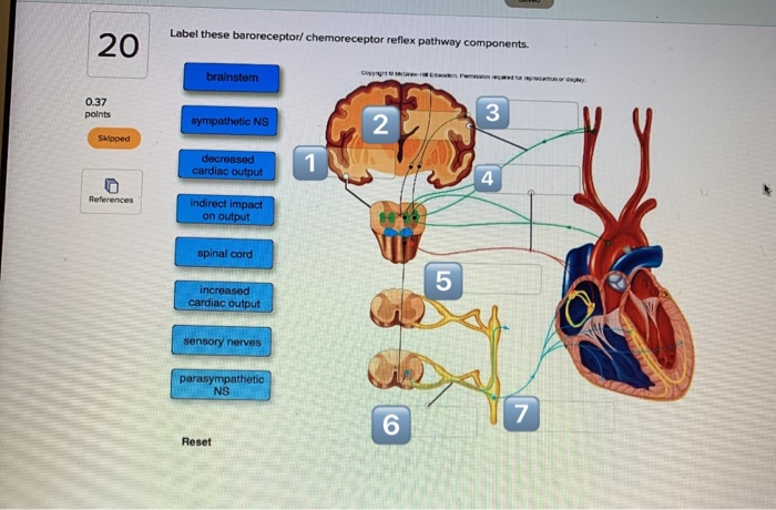 Solved Label these baroreceptor chemoreceptor reflex pathway | Chegg.com