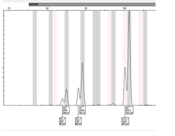 Solved 2. In the following electropherogram, the DNA analyst | Chegg.com