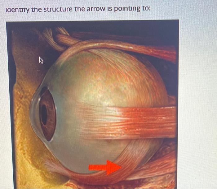 Solved Identify the structure the arrow is pointing to: | Chegg.com