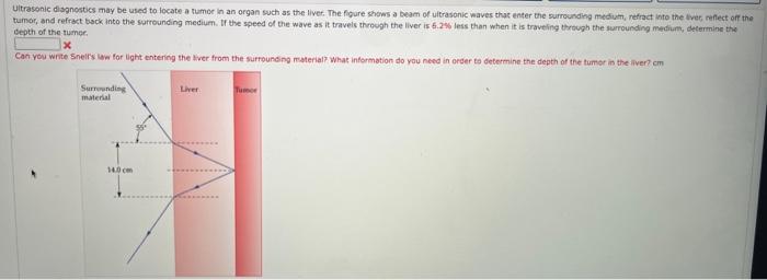 Solved Ultrasonic dlagnostics may be used to locate a fumor | Chegg.com