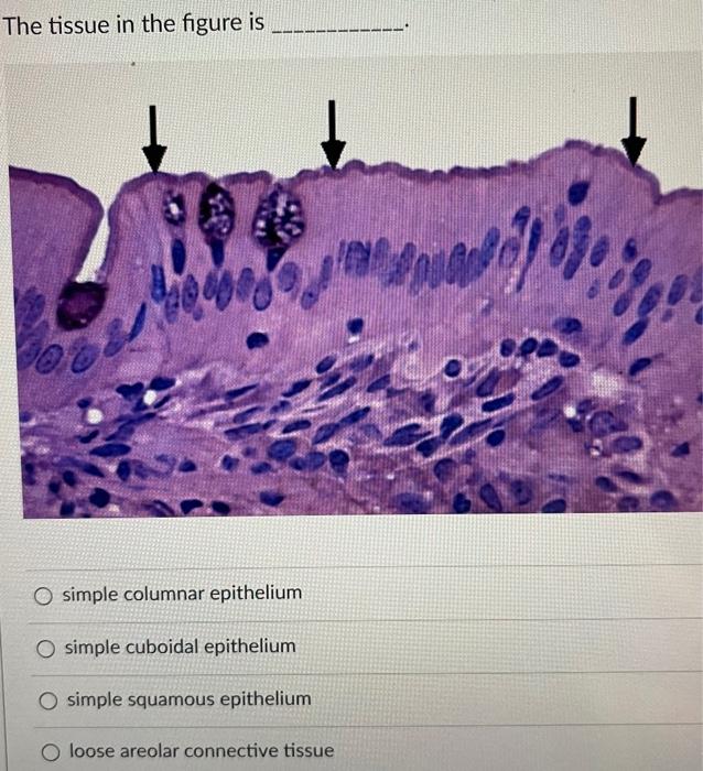 Solved The tissue in the figure is simple columnar | Chegg.com