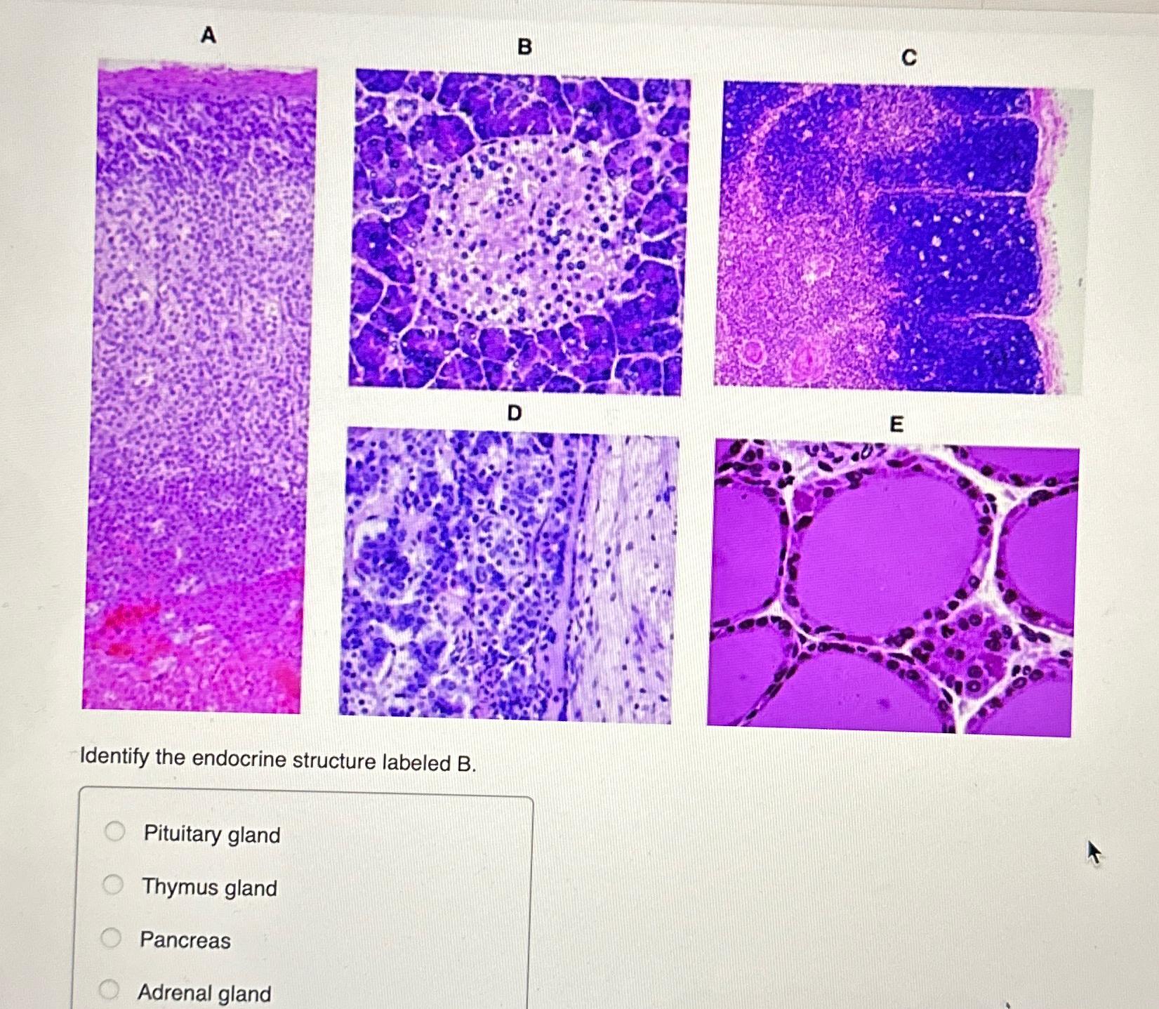 Solved ABCDIdentify the endocrine structure labeled | Chegg.com