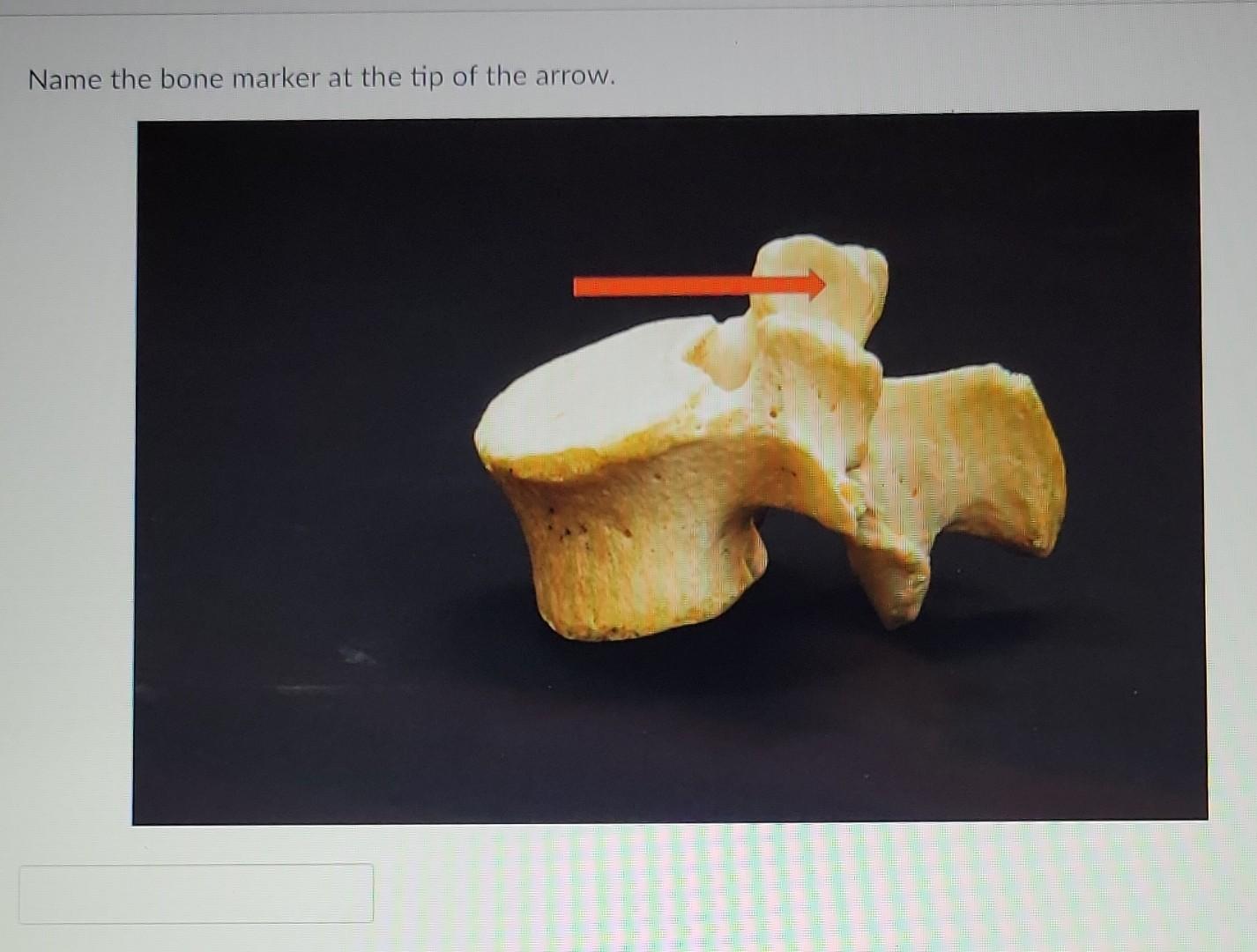 Solved Name the bone marker at the tip of the arrow. Name | Chegg.com