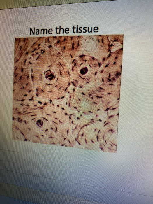 Solved Name the tissue | Chegg.com