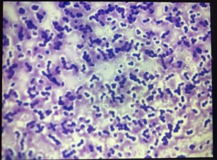 Solved Unknown Bacteria1. Capsule Stain Results (positive or | Chegg.com