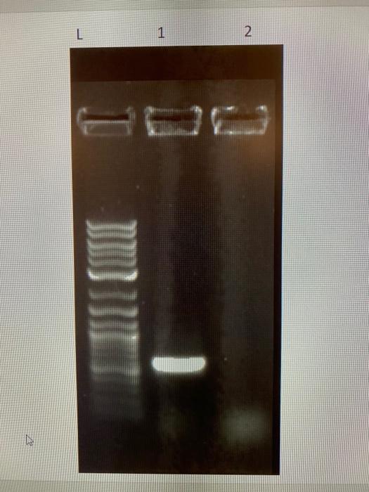 Solved can somebody help me label the ladder to this gel | Chegg.com